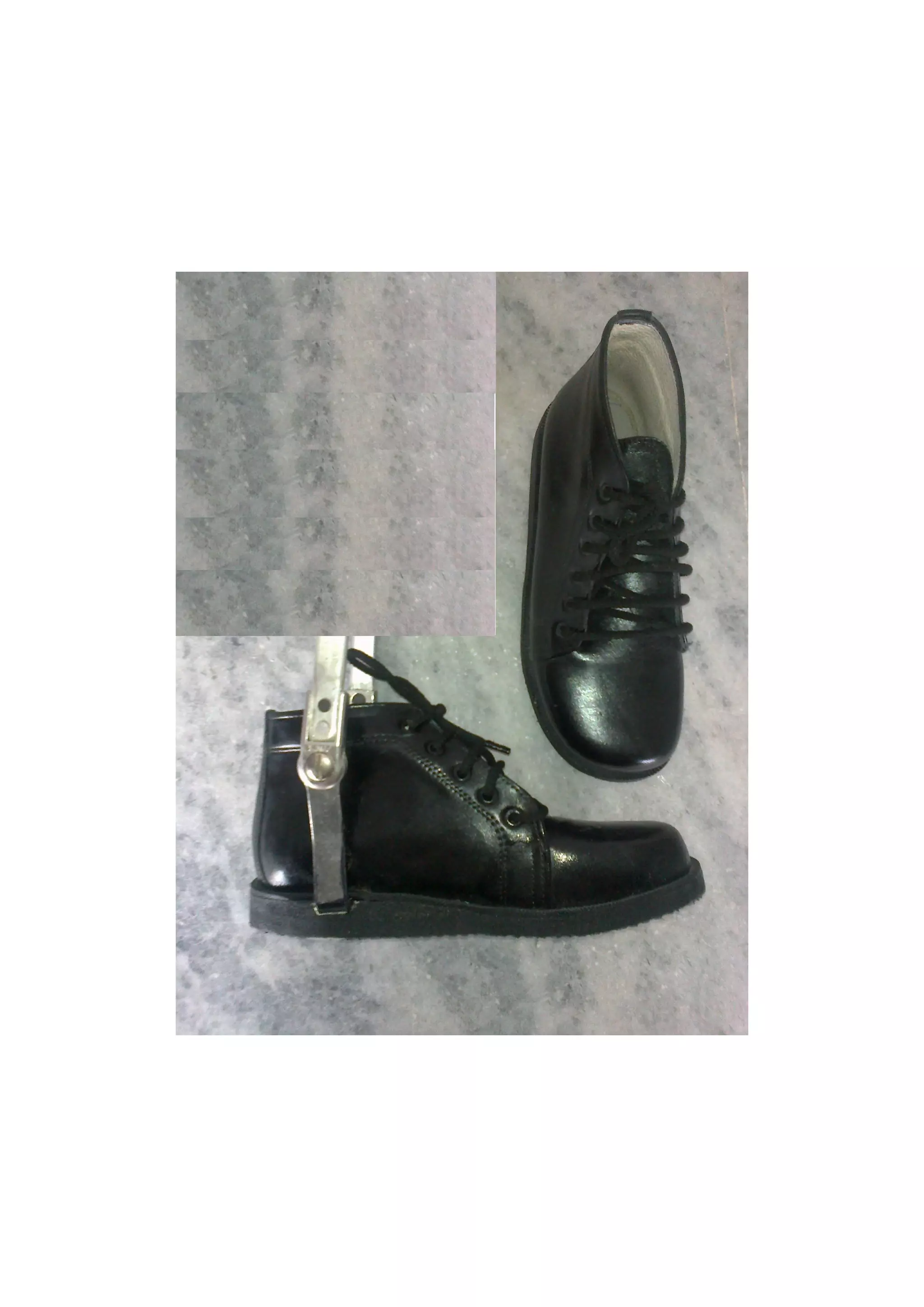 Caliper shoes for polio patients @ My Care Prosthetics and Orthotics | PDF