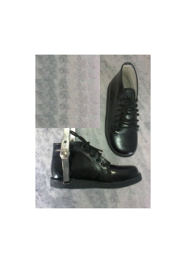 Caliper shoes for polio patients @ My Care Prosthetics and Orthotics | PDF