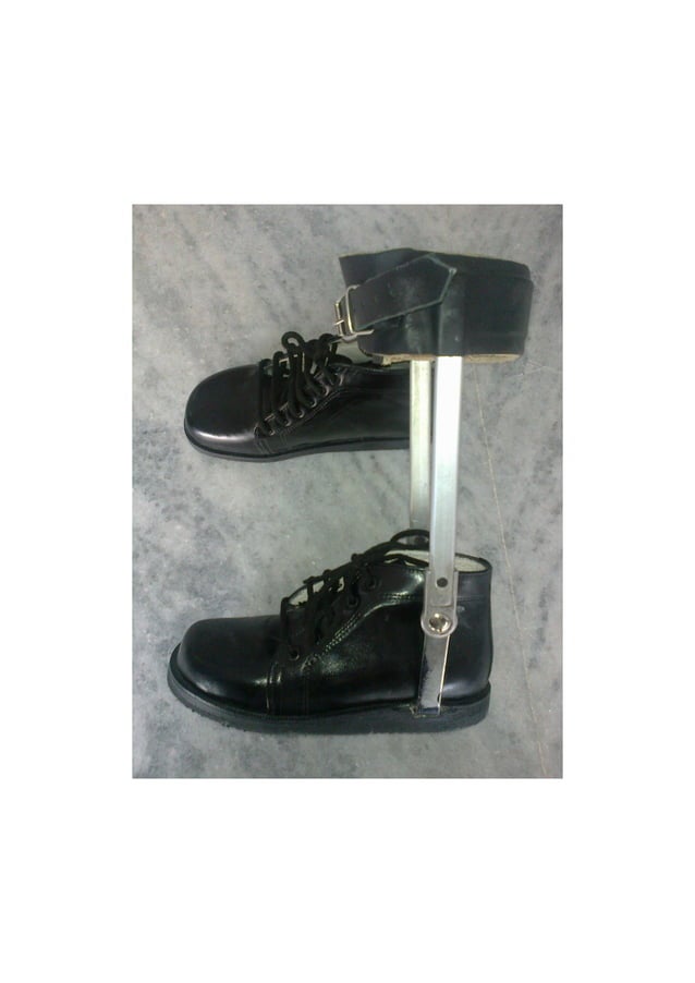 Caliper shoes for polio patients @ My Care Prosthetics and Orthotics | PDF
