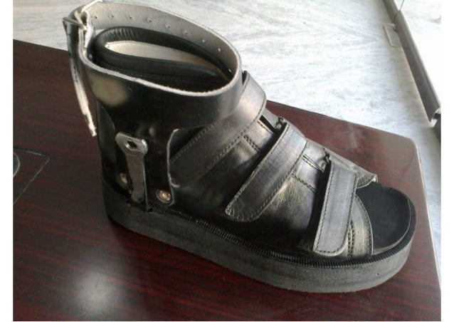Caliper Shoes For Polio Patients My Care Prosthetics And Orthotics
