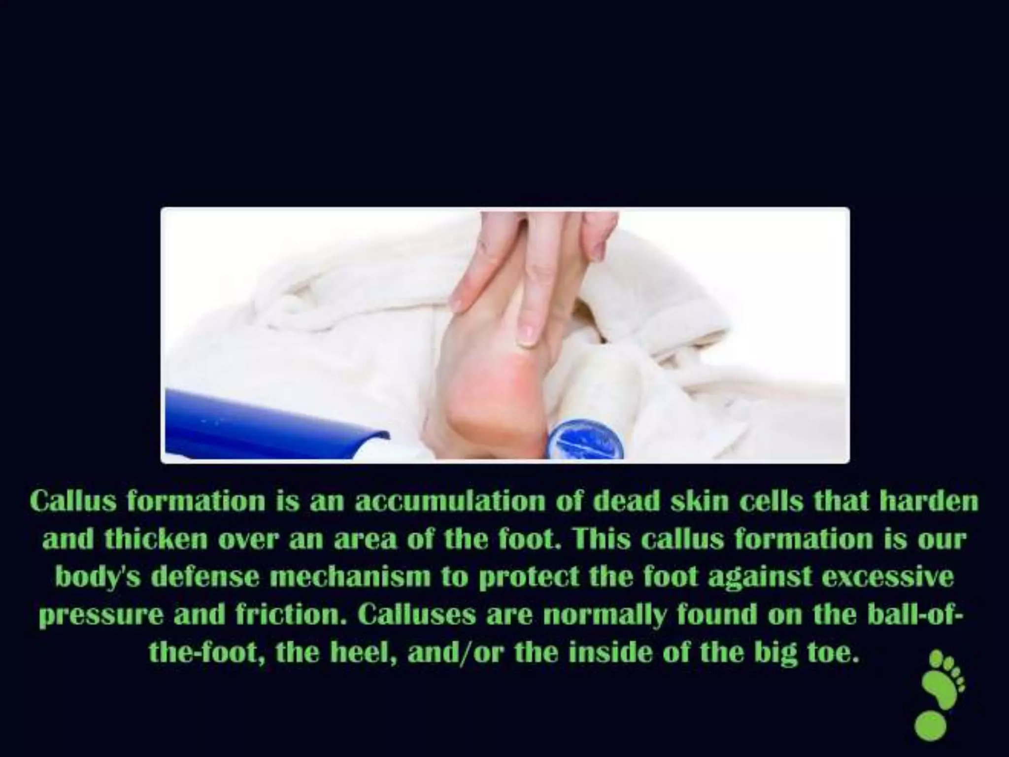 Calluses information & treatment | PPTX