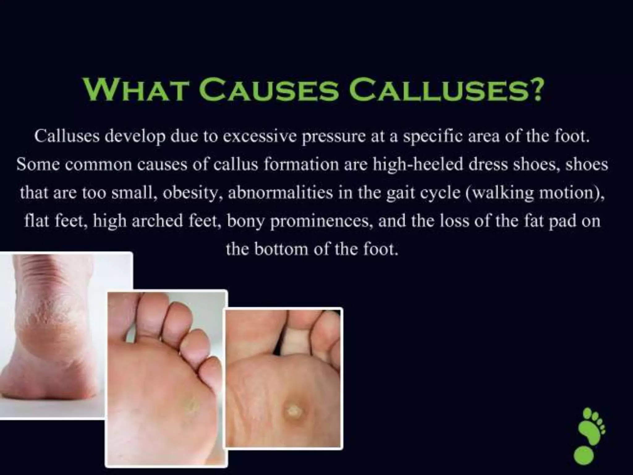 Calluses information & treatment | PPTX