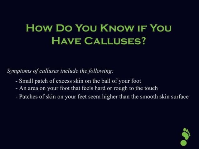 Calluses information & treatment | PPTX