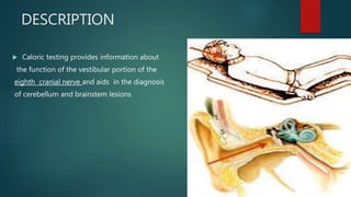 CALORIC TESTING.pptx