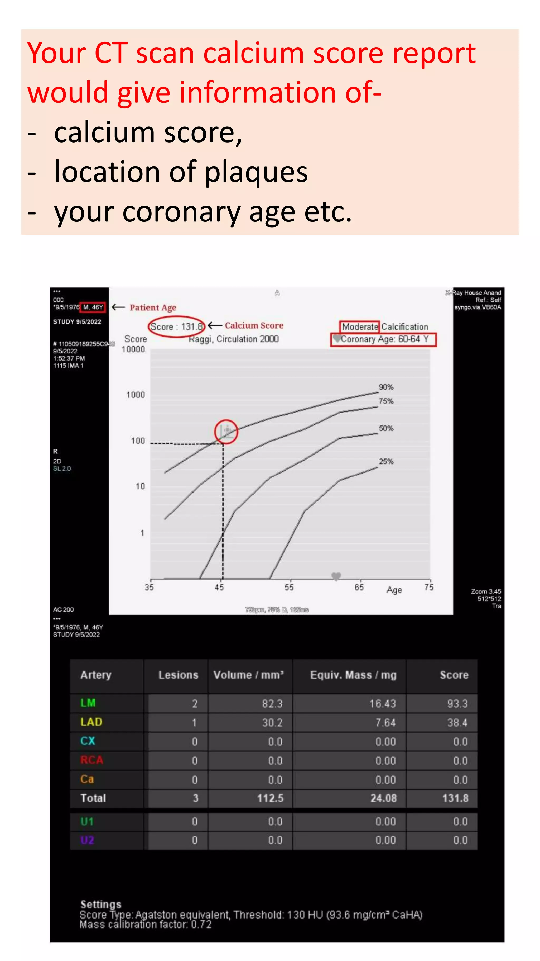 Role of CT Scan Calcium scoring in Coronary Artery Disease | PPT