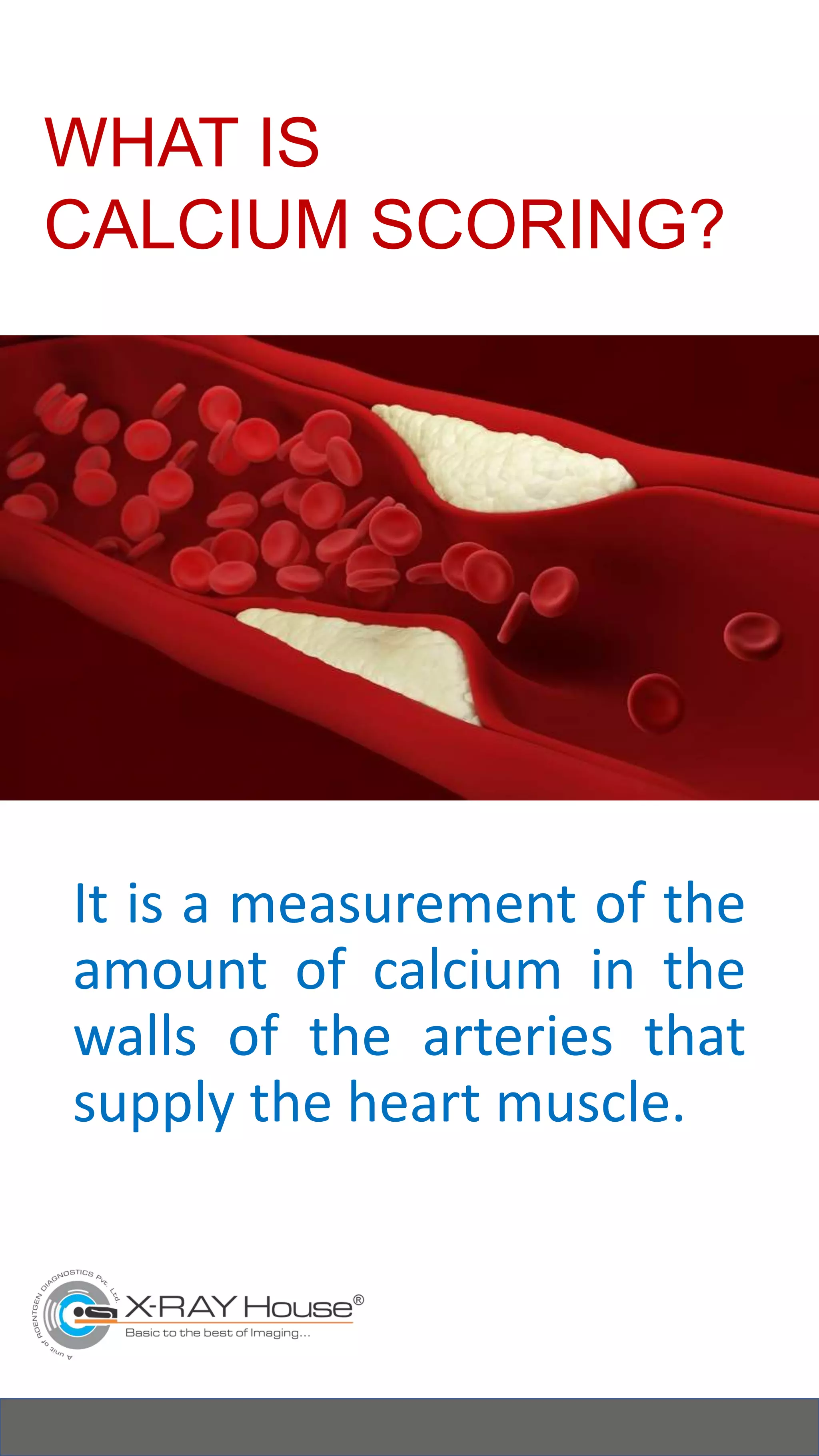 Role of CT Scan Calcium scoring in Coronary Artery Disease | PPT