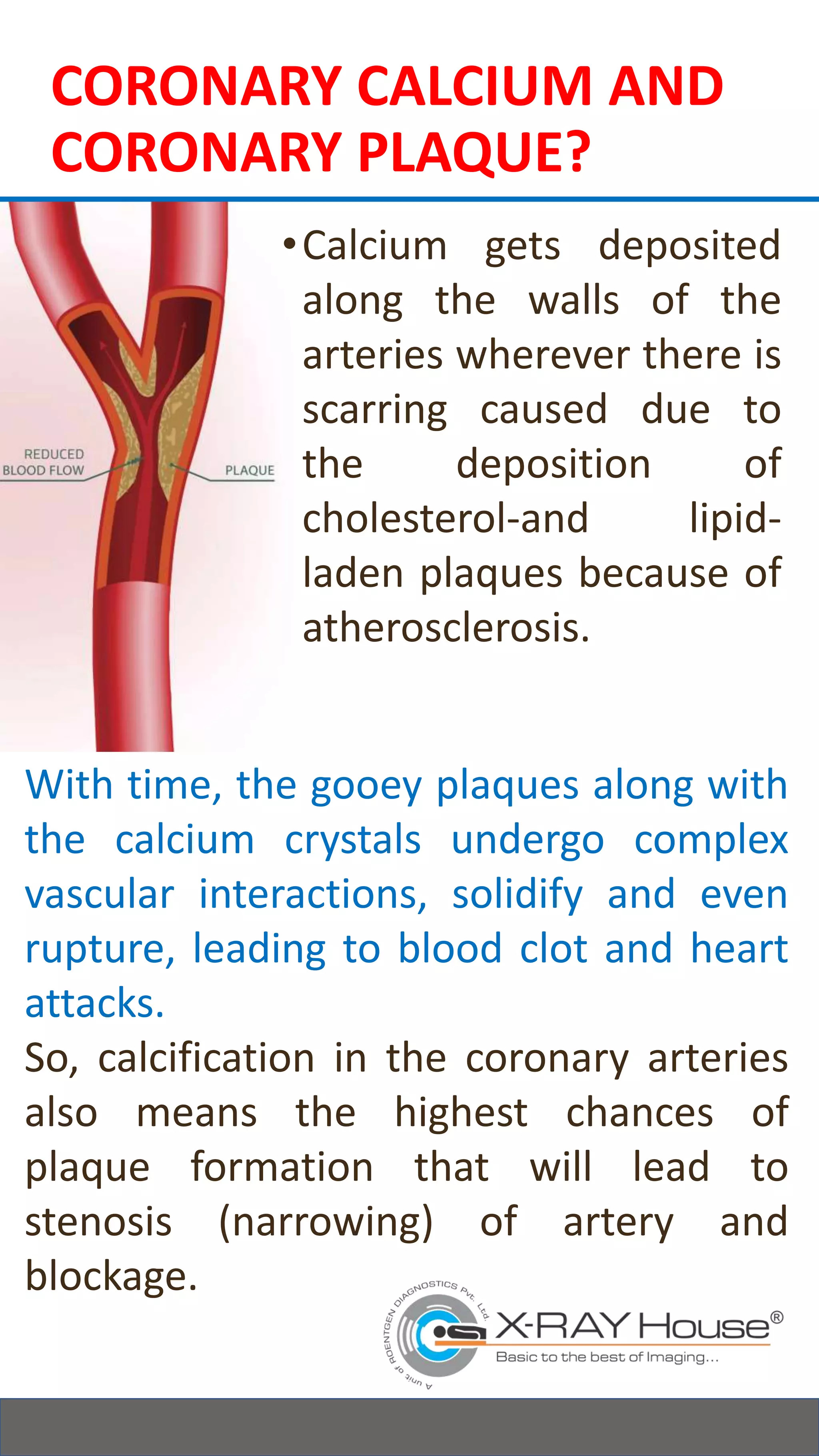 Role of CT Scan Calcium scoring in Coronary Artery Disease | PPT