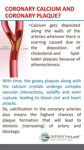 Role of CT Scan Calcium scoring in Coronary Artery Disease | PPT