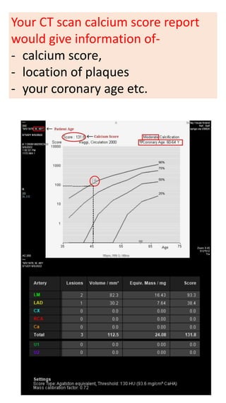 Role of CT Scan Calcium scoring in Coronary Artery Disease