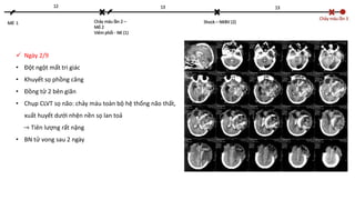Ca LS CTSN nặng.pptx