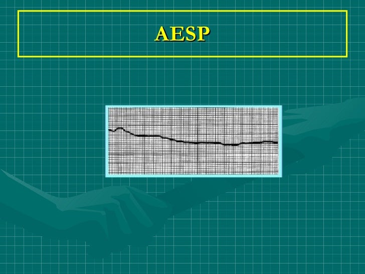 Reanimación Cardio Pulmonar