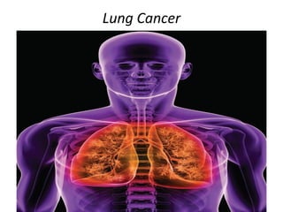 Ca lung | PPT