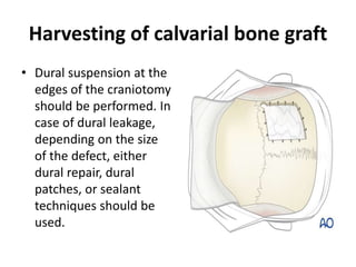 Calvarial bone graf harvesting | PPTX