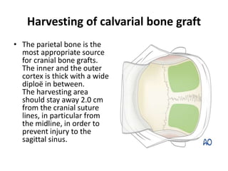 Calvarial bone graf harvesting | PPTX