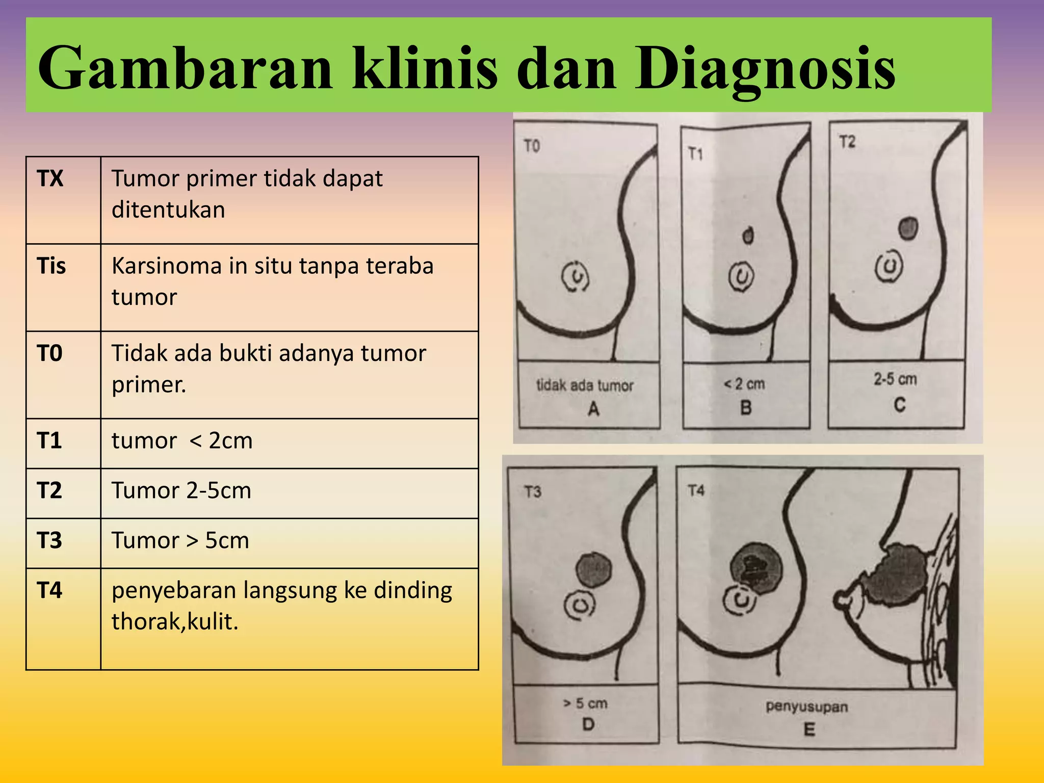 CA_MAMMAE_SLIDE_DHITA.pptx