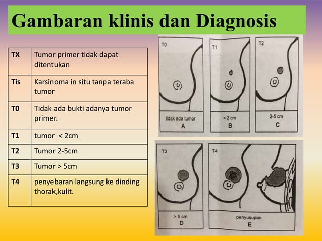 CA_MAMMAE_SLIDE_DHITA.pptx