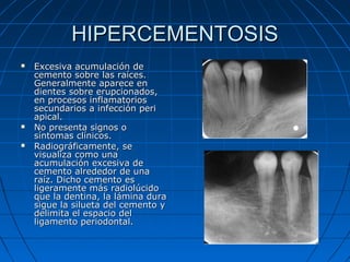 Cambios regresivos | PPT