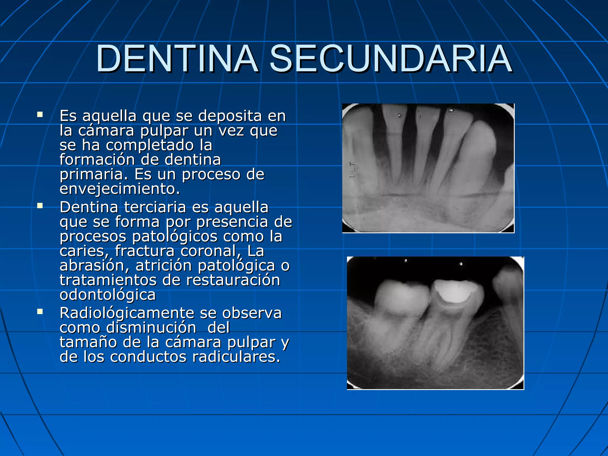 Cambios regresivos | PPT