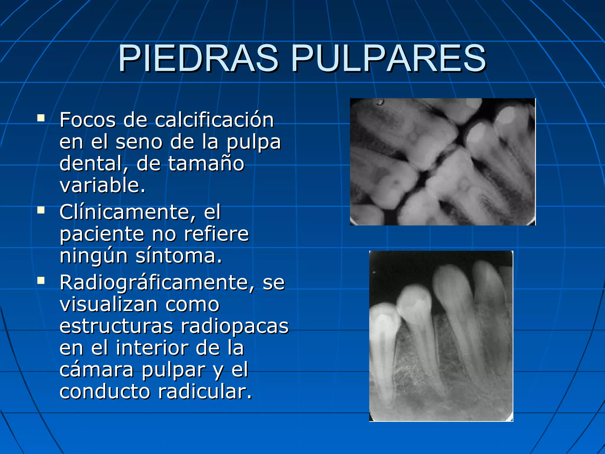 Cambios regresivos | PPT