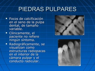 Cambios regresivos | PPT