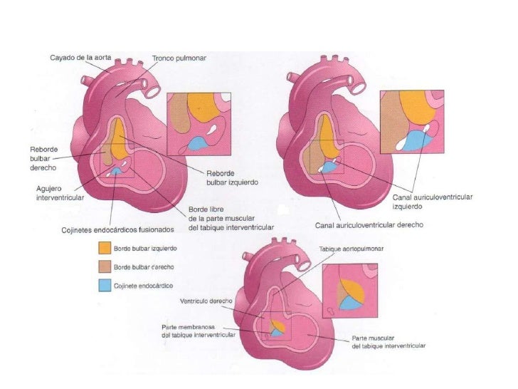 Cambios del seno venoso Fonseca