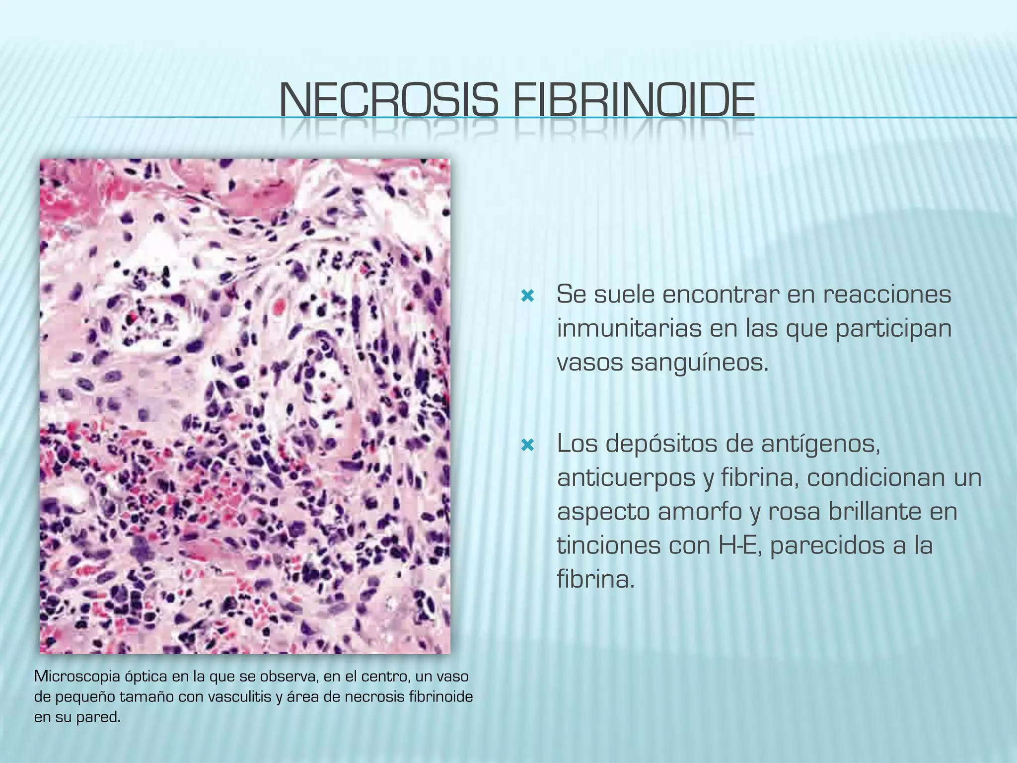 Cambios morfologicos celulares en la necrosis full version1.2 | PDF
