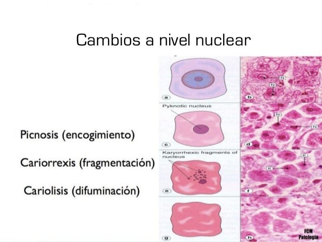 Cambios morfologicos celulares en la necrosis full version1.2