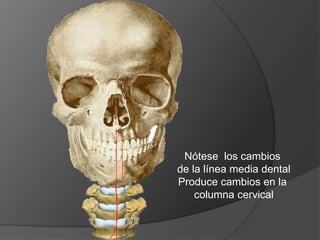 Linea media desviada signo de cambios posturales | PPTX