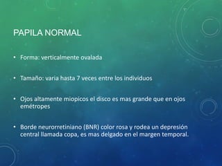 Cambios papilares en el glaucoma | PPTX