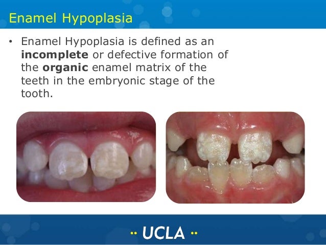 Cambra - A Clinical Review