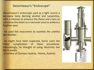Camera in laparoscope | PPTX