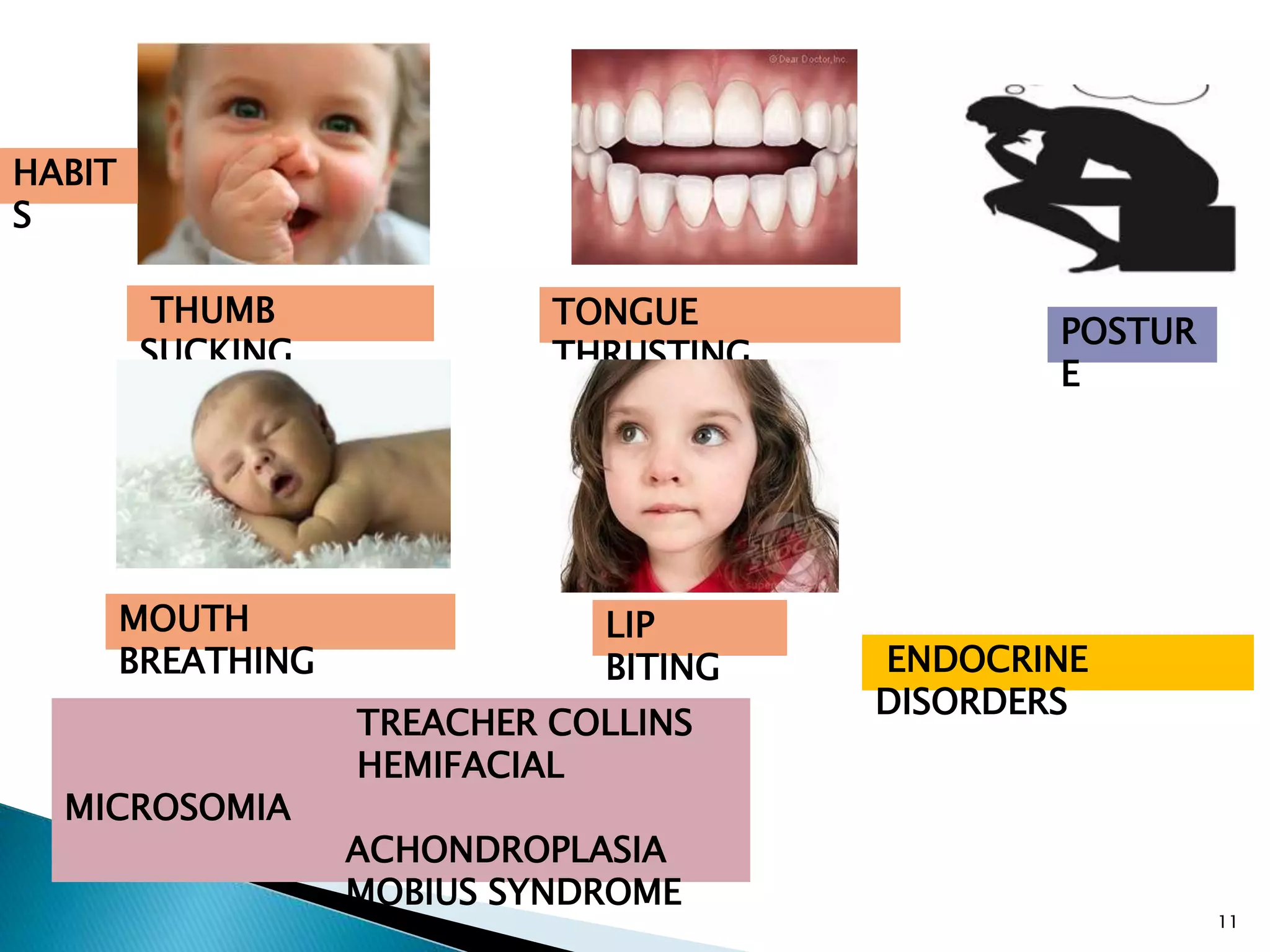 Camouflage in orthodontics | PPTX
