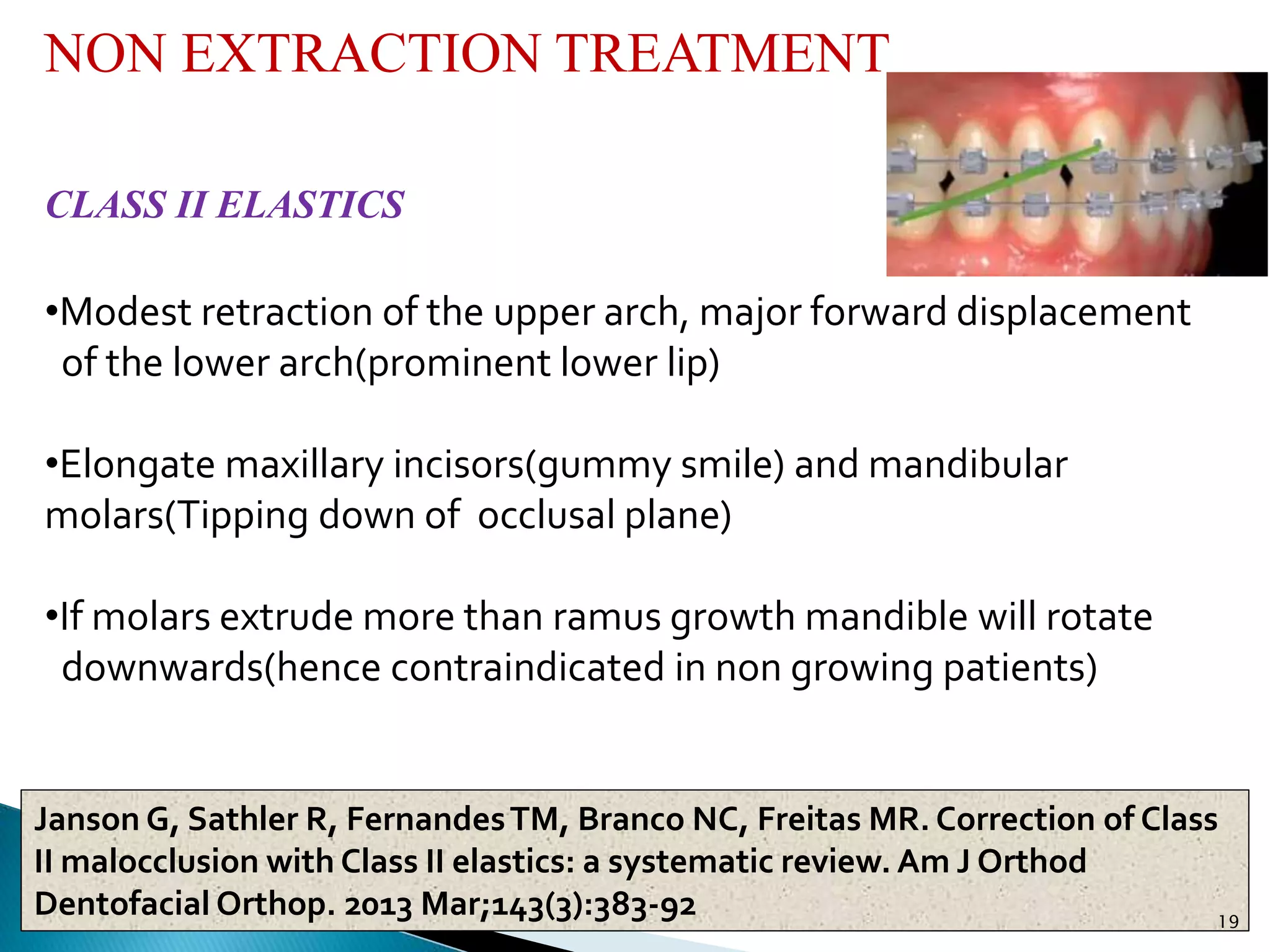 Camouflage in orthodontics | PPTX