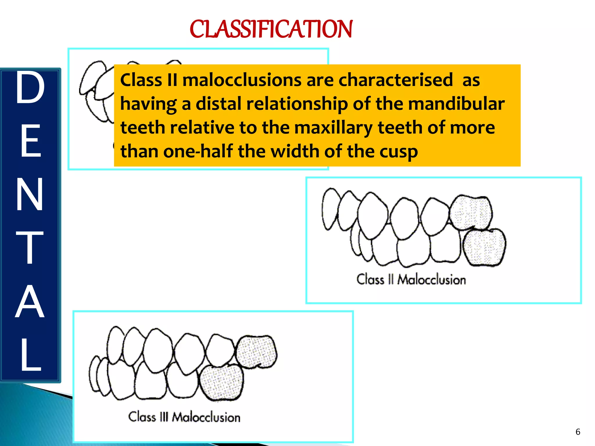 Camouflage in orthodontics | PPTX