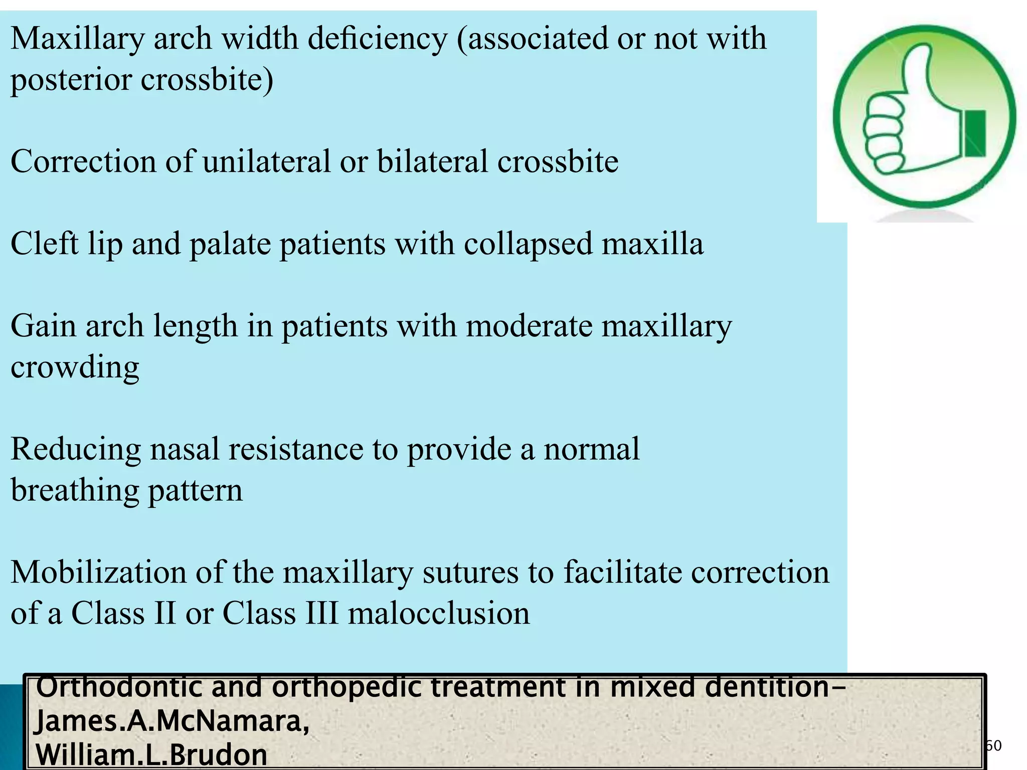 Camouflage in orthodontics | PPTX