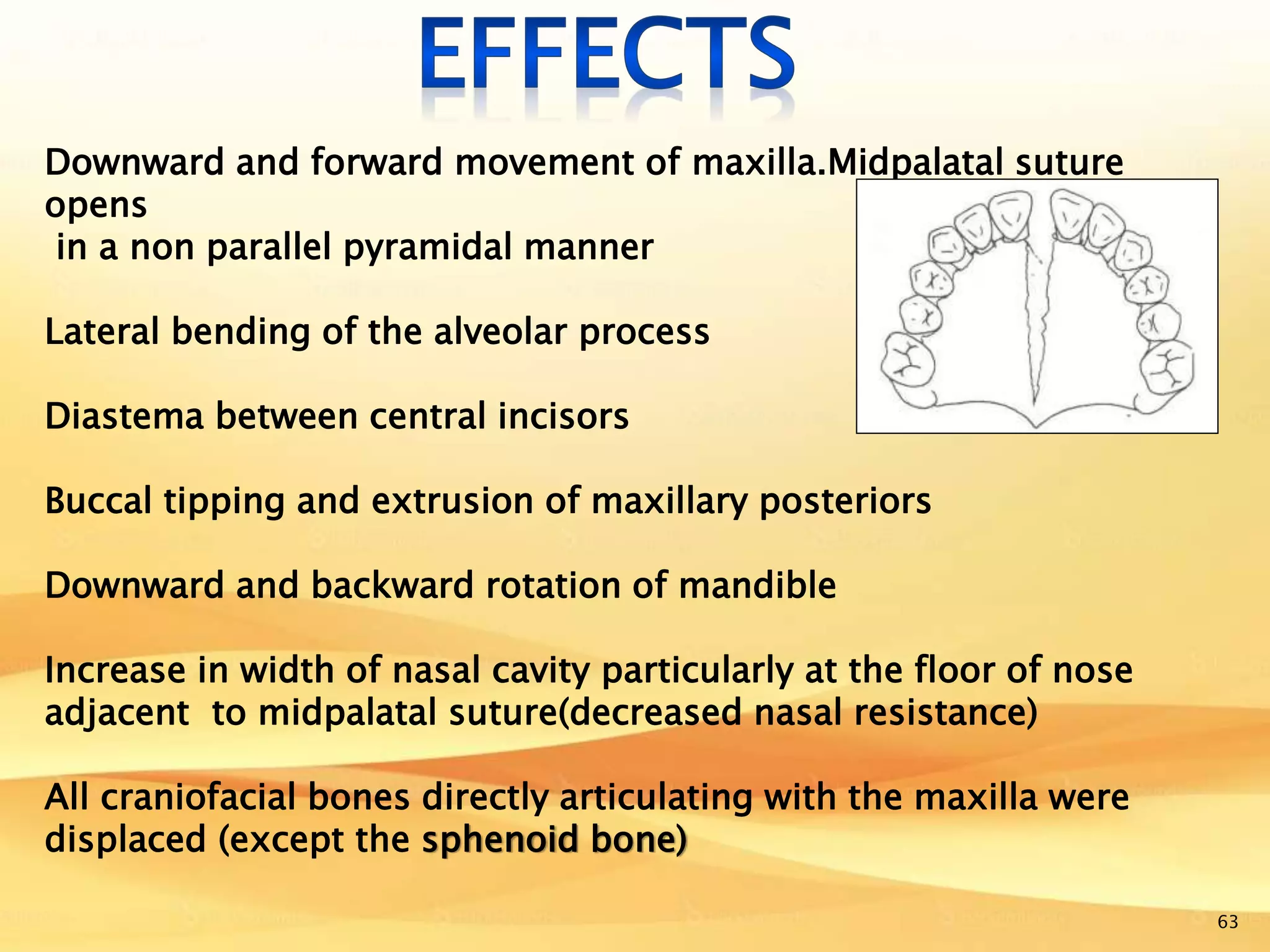 Camouflage in orthodontics | PPTX