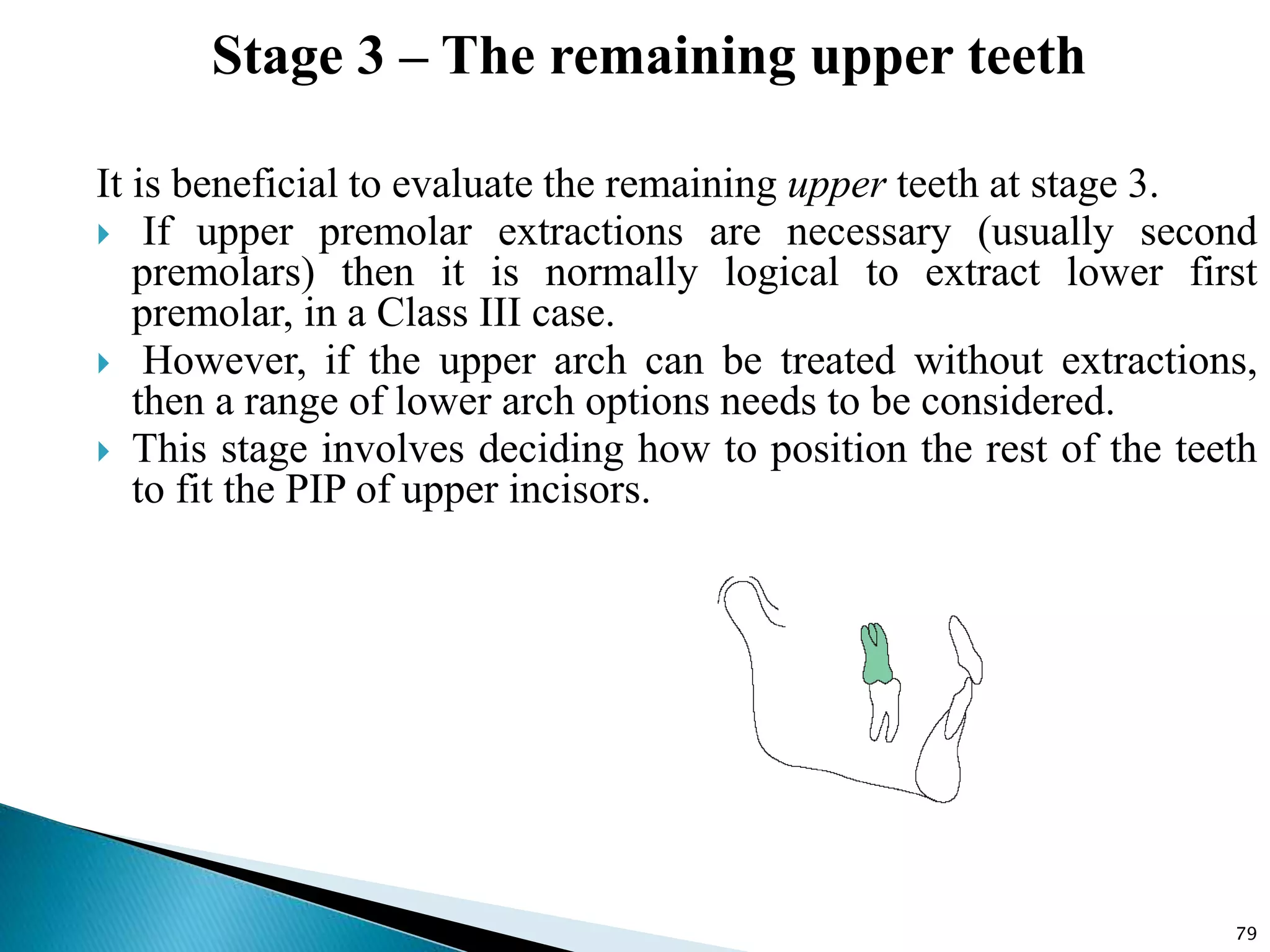 Camouflage in orthodontics | PPTX