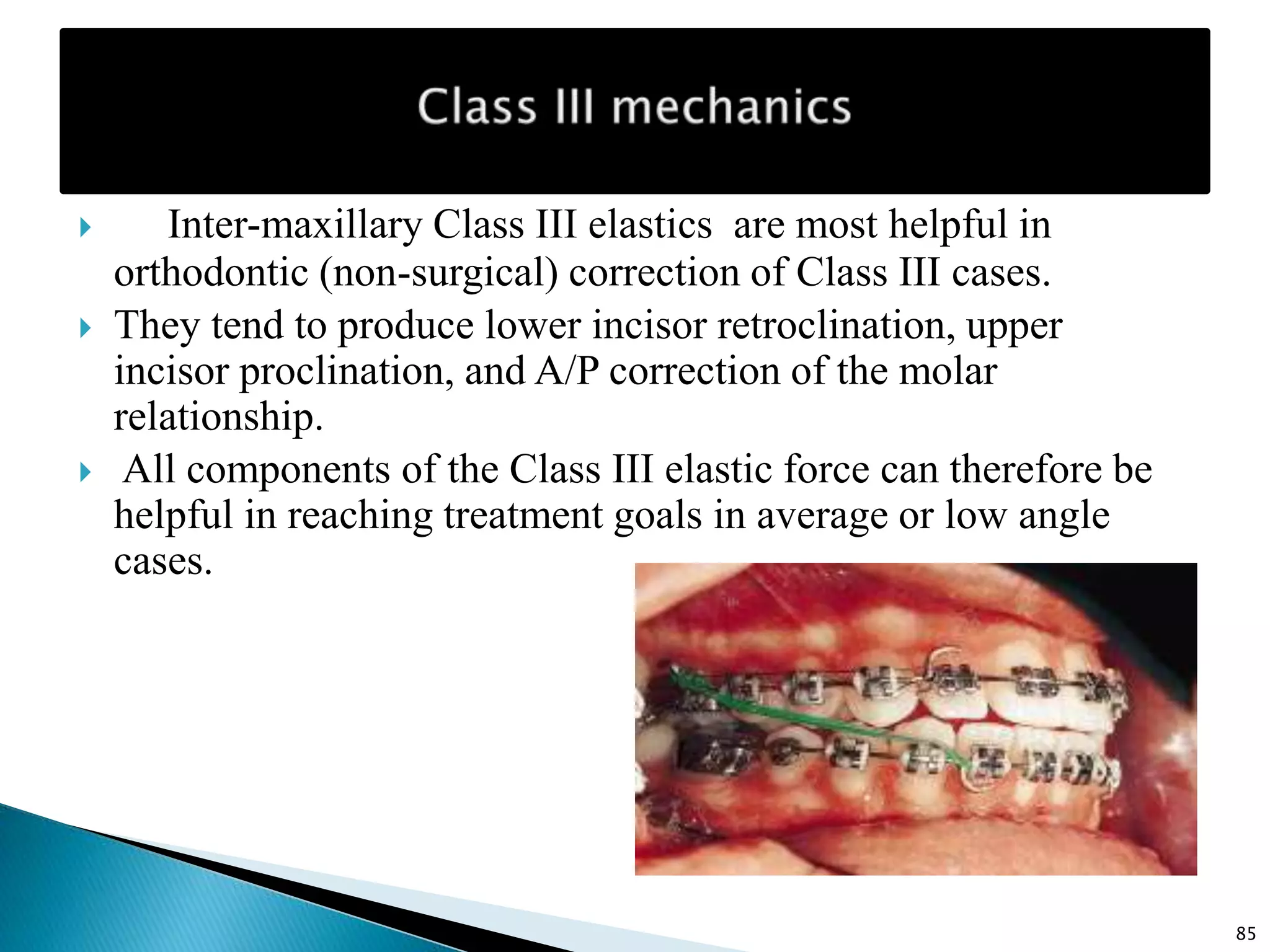 Camouflage in orthodontics | PPTX