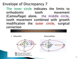Camouflage in orthodontics | PPTX