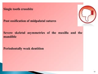 Camouflage in orthodontics | PPTX
