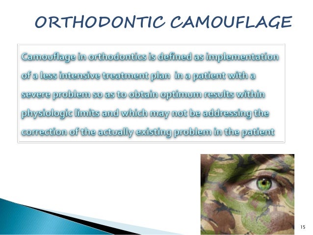 Camouflage in orthodontics