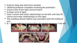 nnnnnnnnnnnF SKELETAL CLASS III (1).pptx