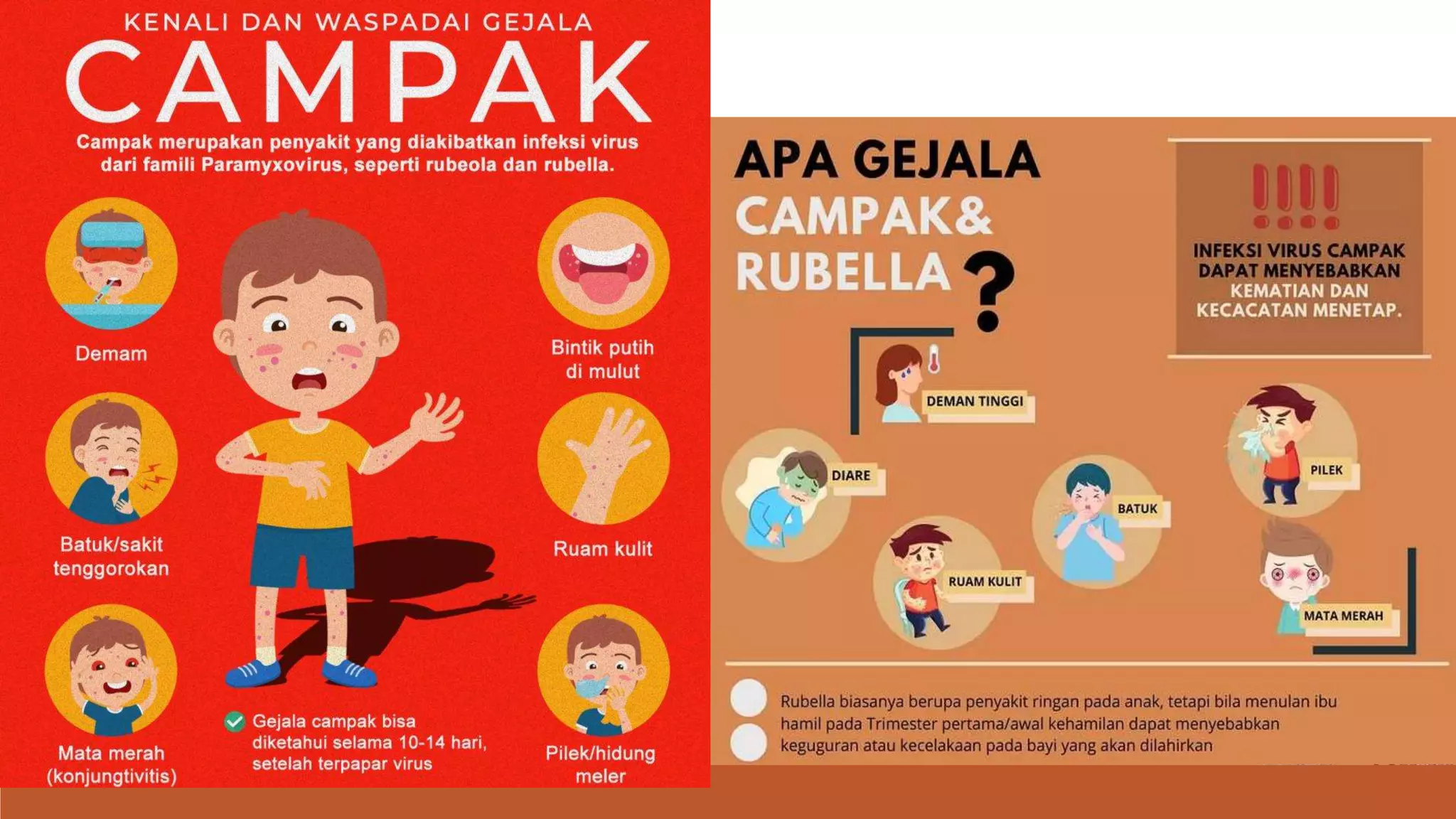 Campak dan Rubella.pptx