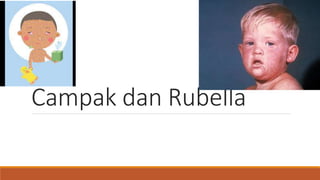 Campak dan Rubella.pptx