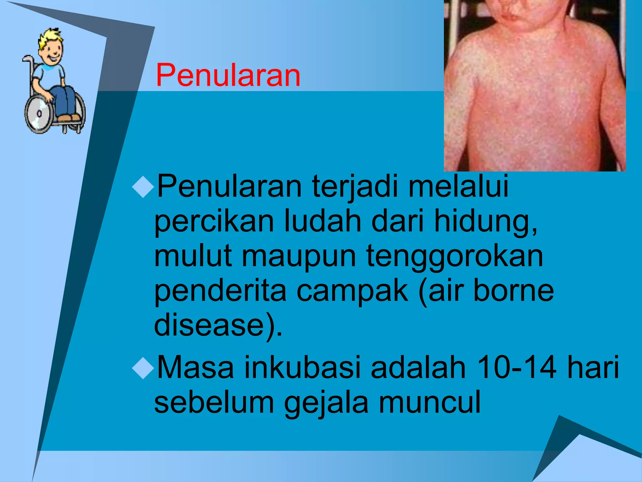 CAMPAK_ppt.ppt
