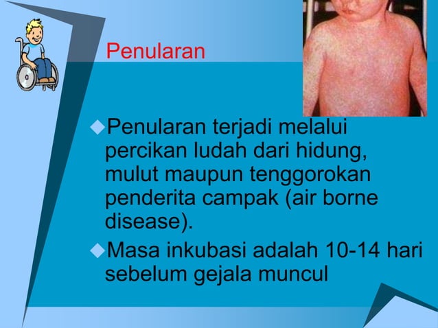 CAMPAK_ppt.ppt