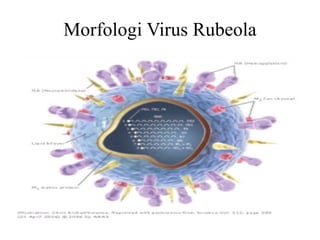 Campak PPT TROPIS.pdf