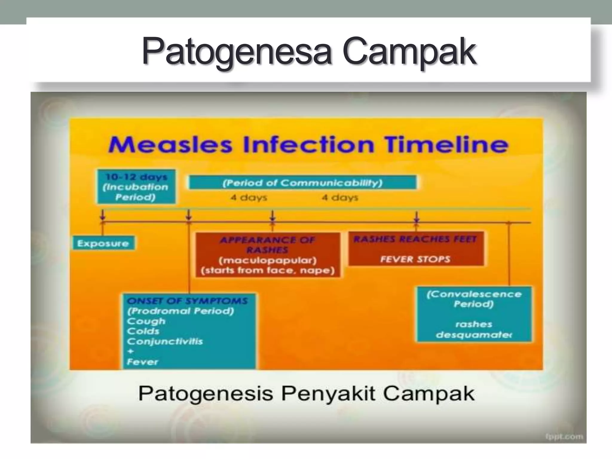 CAMPAK RUBELLA.pptx