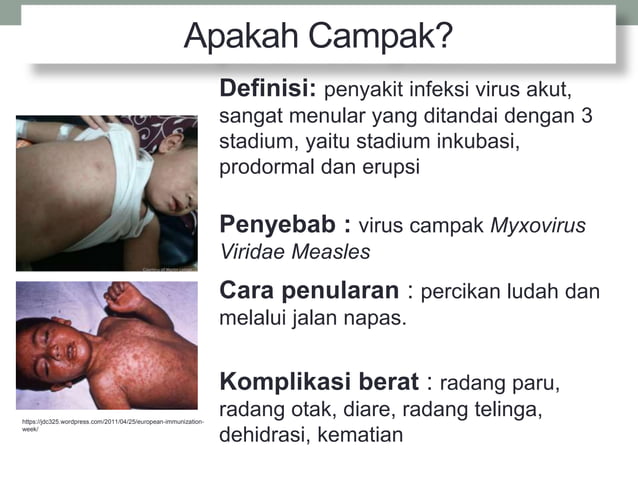 CAMPAK RUBELLA.pptx