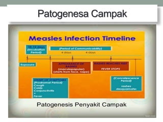 CAMPAK RUBELLA.pptx